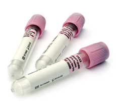 INNO | Making the difference in animal care: Colheita de proBNP