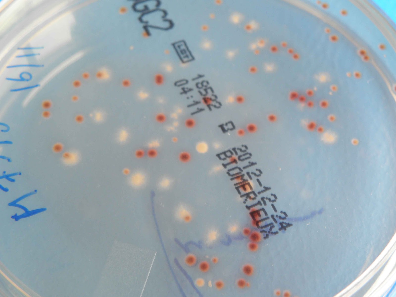 ATLAS MICOLOGIA: TRICHOPHYTON VIOLACEUM