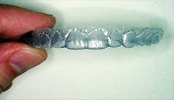 Wheaton Orthodontist: So, you just finished braces, NOW WHAT? (ALL ...