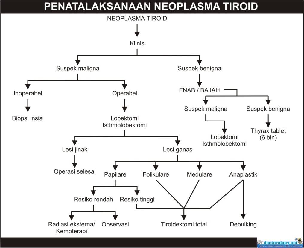Neoplasma Tiroid