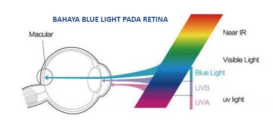 Dampak Blue Light – Sinar Biru untuk Bola Mata yang Patut Anda Ketahui ...