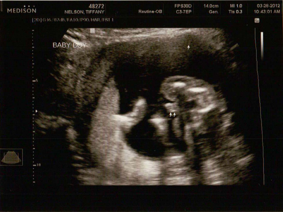 Sonogram pics with boy parts! | The Nelson Baby Making Blog