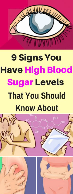 9 Signs You Have High Blood Sugar Levels That You Should Know About 9-signs-you-have-high-blood-sugar-levels-that-you-should-know-about