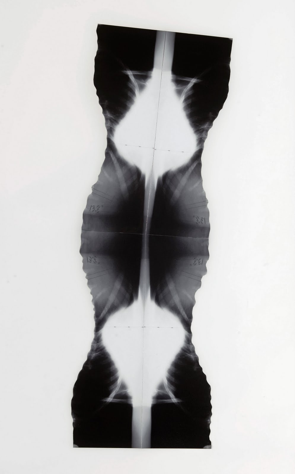 Jason Eden: X - Rays