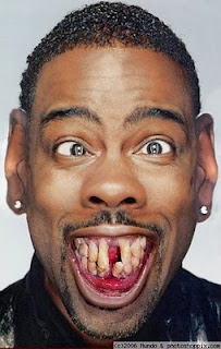 Funny teeth pics - ONLINE NEWS ICON