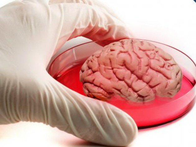 Studii, descoperiri si noutati despre autism: Autism – Analiza unui ...