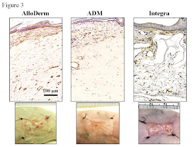 My unpublished biomedical research: Wound Neovascularization with ...