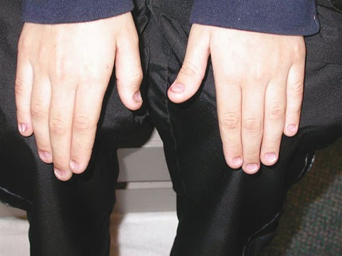 EL RINCÓN DE LA MEDICINA INTERNA: 24-feb-2013