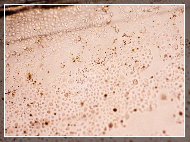 努力不一定會成功, 但成功一定需要努力!: 血球吸附試驗 (hemadsorption test, HAd)