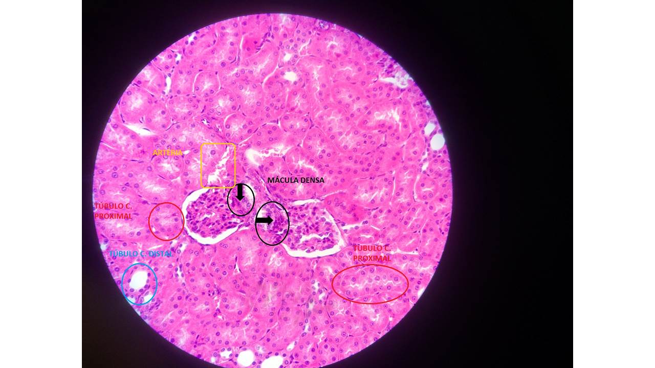 HISTOLOGIA90: RIM NORMAL E GLOMERULONEFRITES