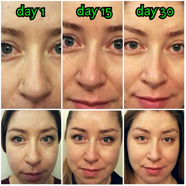 Top 105+ Pictures Collagen Powder Before And After Pictures Superb