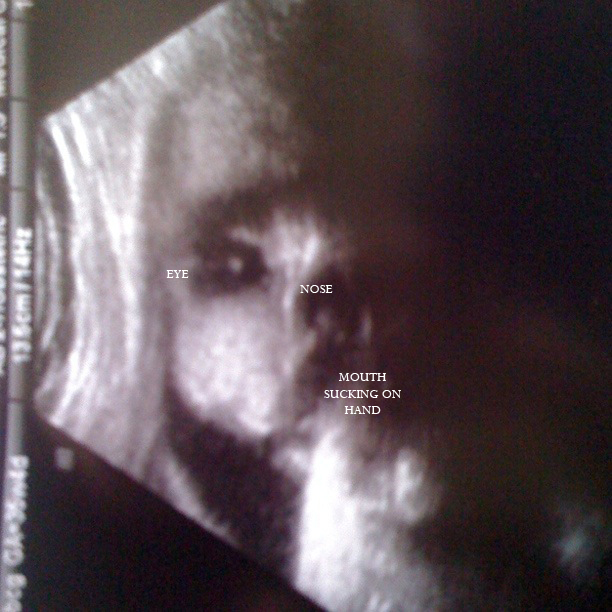 brooke's excerpts & extracts: 35 weeks Pregnant!