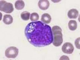 HEMATOLOGIA: BASOFILIA