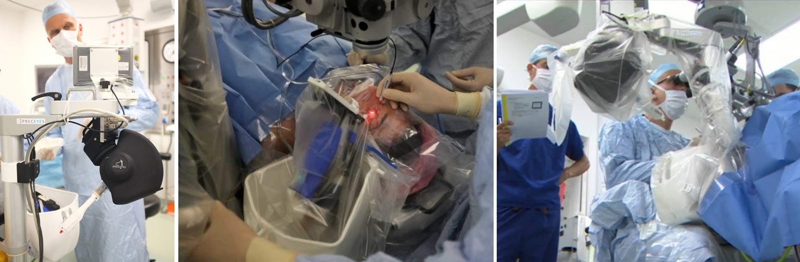 Latest in robotic human eye surgery