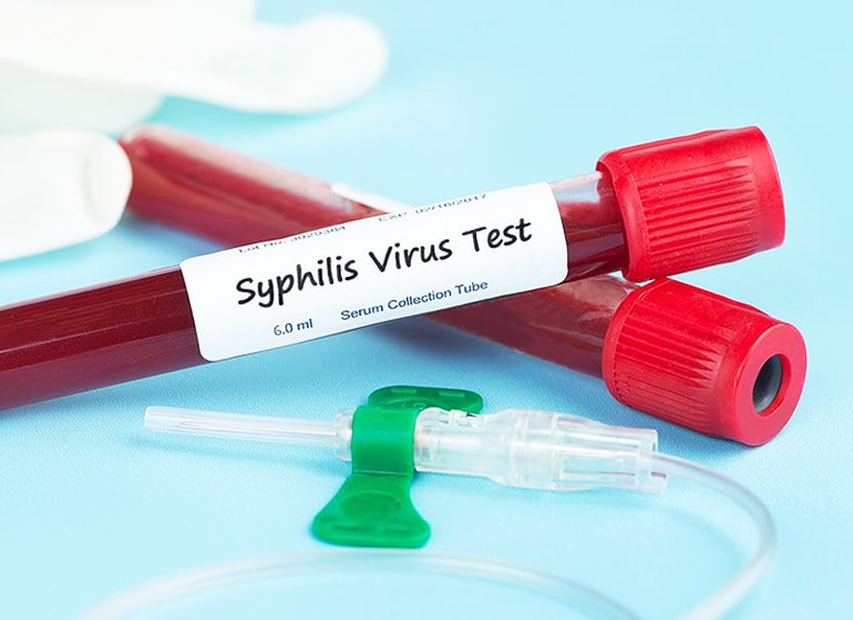 Planificación Familiar: Sífilis