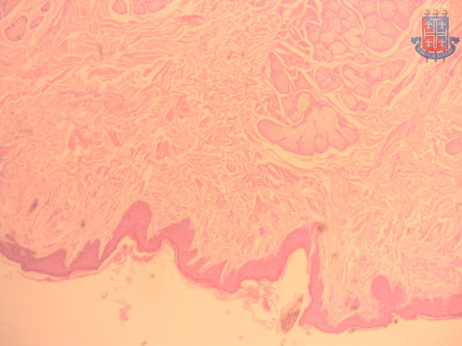 Atlas virtual de histologia e patologia: Pele Pilosa