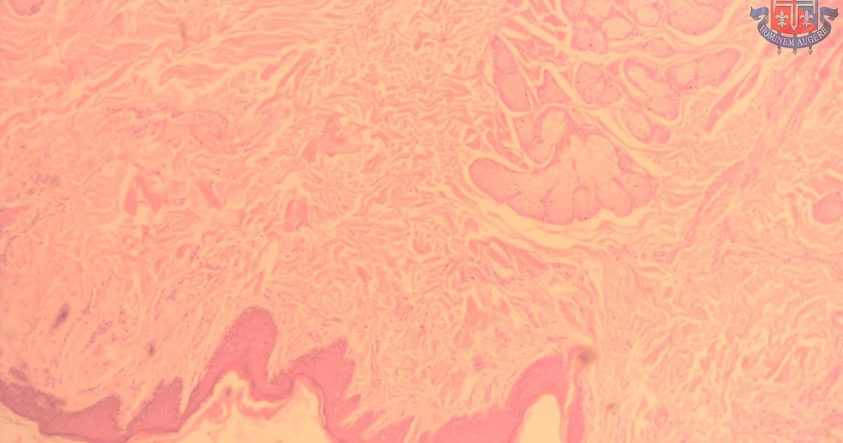 Atlas virtual de histologia e patologia: Pele Pilosa