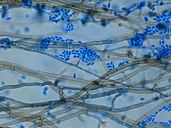 Fun With Microbiology (What's Buggin' You?): Pleruostomophora richardsiae
