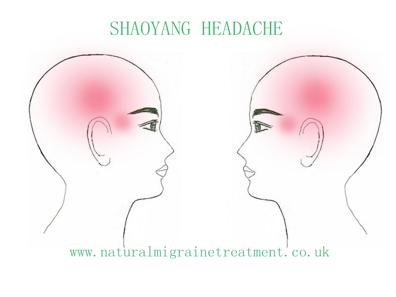 Natural Migraine Treatment: The 6 different types of Migraine related ...