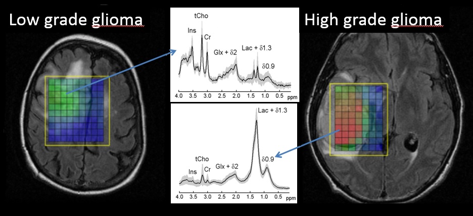 Healthcare, etc.: Joel Winer, M.D.:The Practice of Neurosurgery