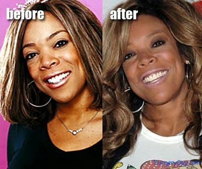 Wendy Williams Plastic Surgery Nose Job, Breast Implants Before and ...
