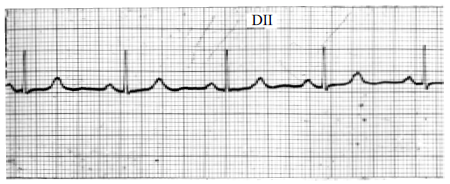 Blog del Internista: Resumenes de Cardiología VII - Características del ...