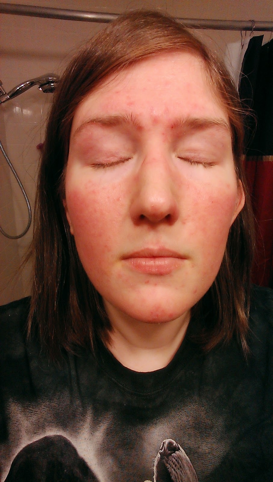 Prosacea Review: February 2015