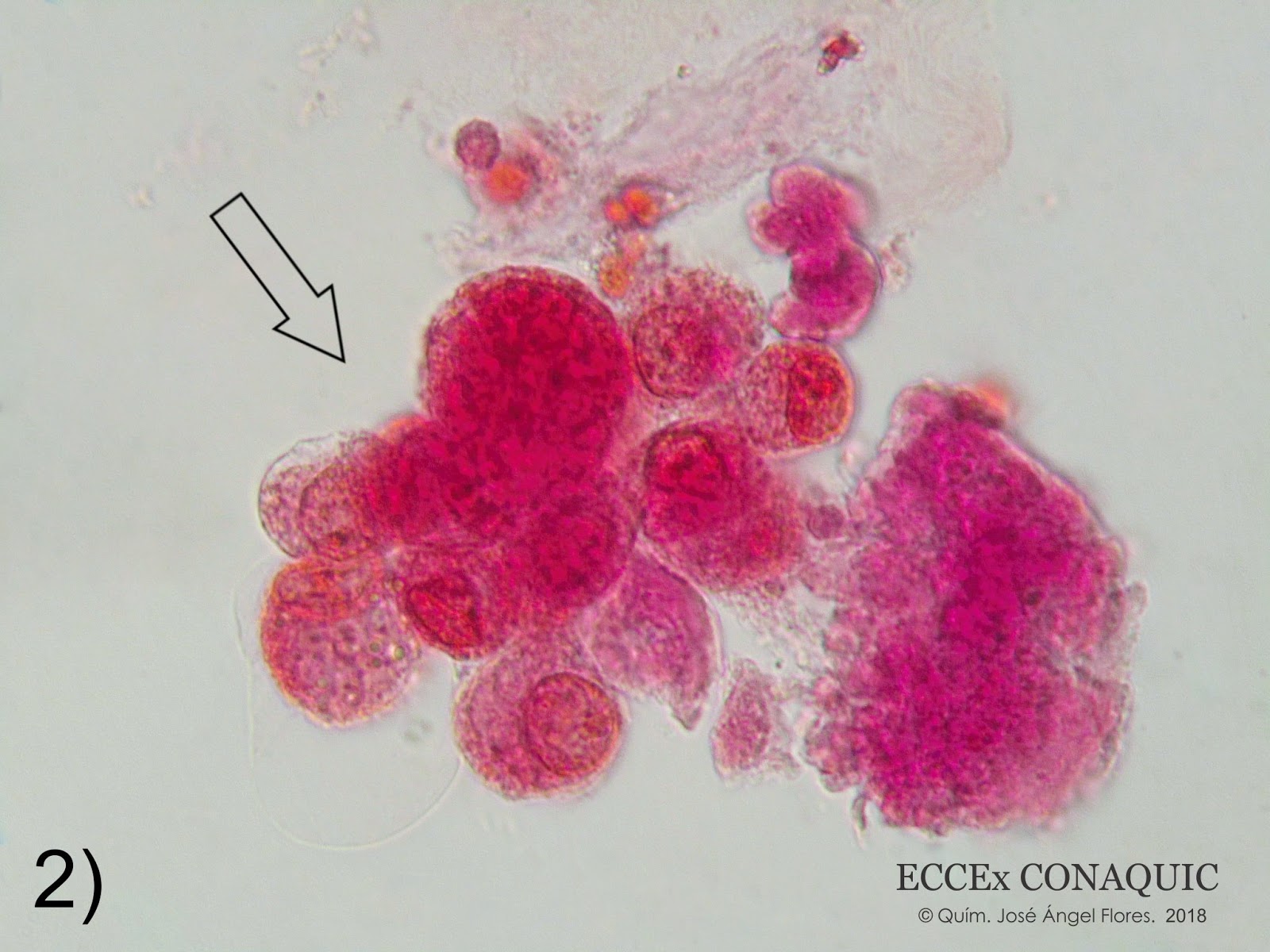 Examen General de Orina: 2018