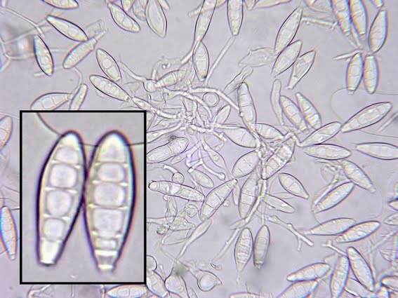 Fun With Microbiology (What's Buggin' You?): Microsporum canis