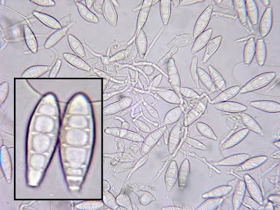 Fun With Microbiology (What's Buggin' You?): Microsporum canis