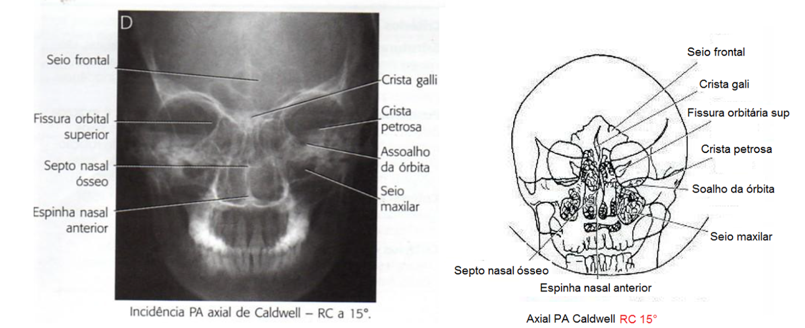 Laboratório de Roentgen: Crânio e Face