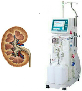 FGI E-CLINIC : KIDNEY FAILURE