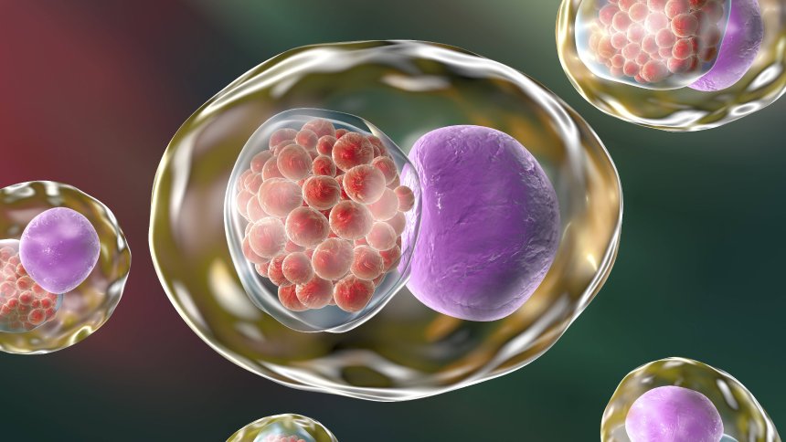 A Comprehensive Approach for Mycetoma Management