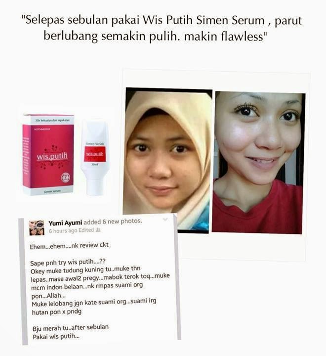 hanimfara.blogspot.com: WIS PUTIH SKINCARE ~ FREE HYDROKINON