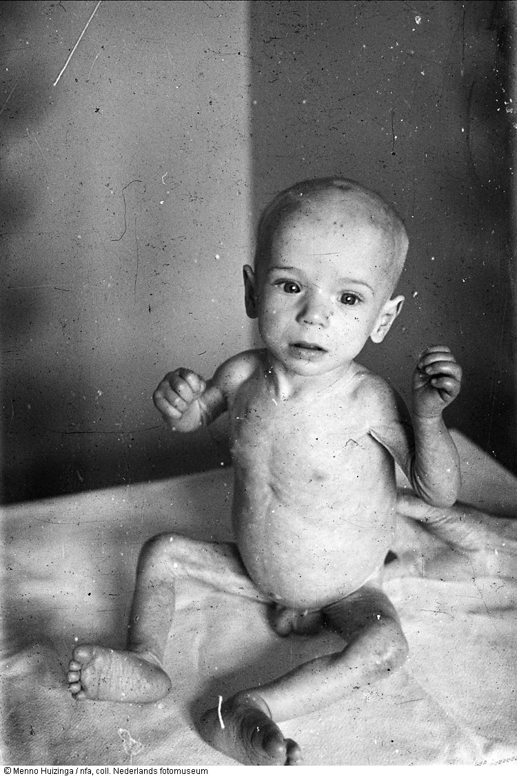 World 1900 - 1950: Dutch famine of 1944-1945 ( known as the Hongerwinter)