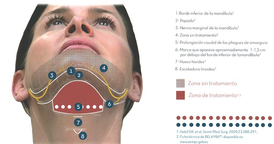 Botox, Acido Hialurónico, Bichectomia, Invisible Touch Hilos Pdo