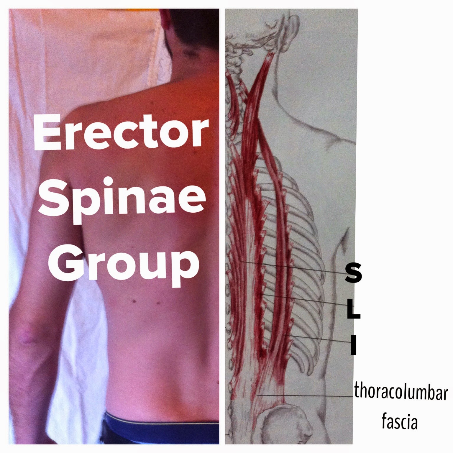 The Hip Joint: Erector Spinae Group