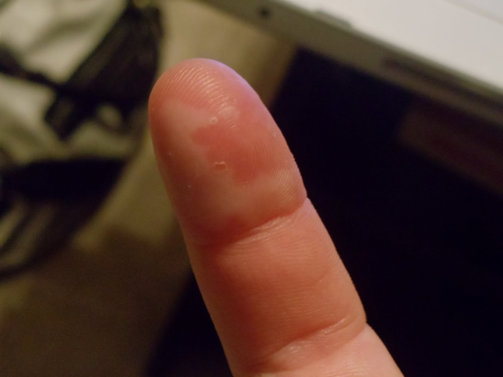 The Grub Tub: Dinner and a burnt finger