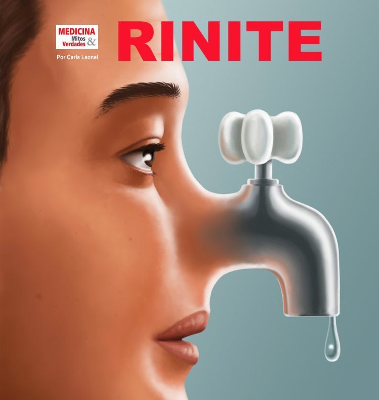 Nem te contei...: Rinite Alérgica - Papo Saúde