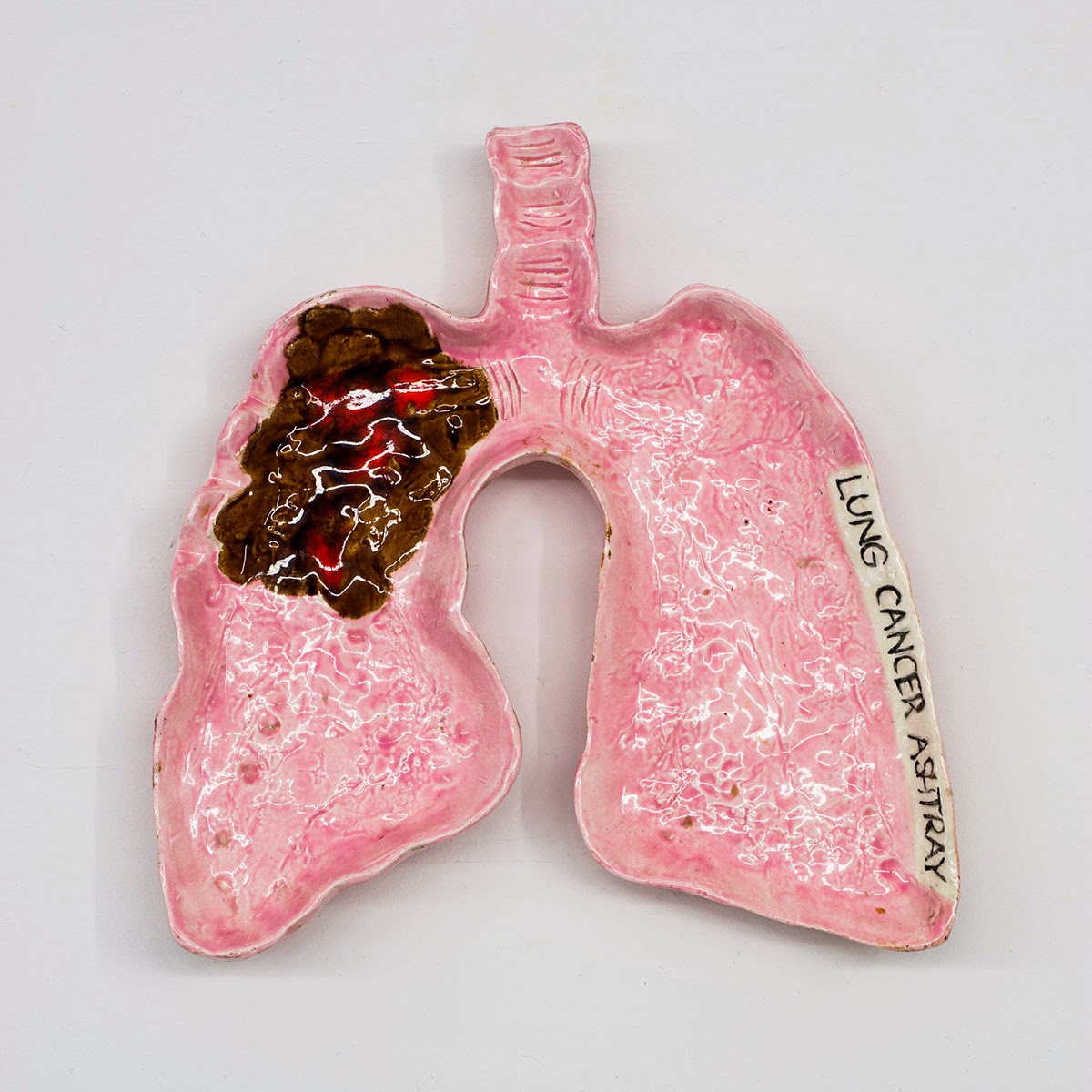 "Lung Cancer Ashtrays," 1984, Becky Howland