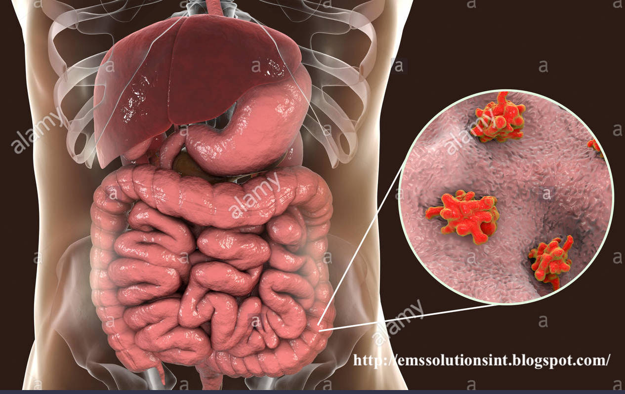 EMS SOLUTIONS INTERNATIONAL by @DrRamonReyesMD marca registrada ...