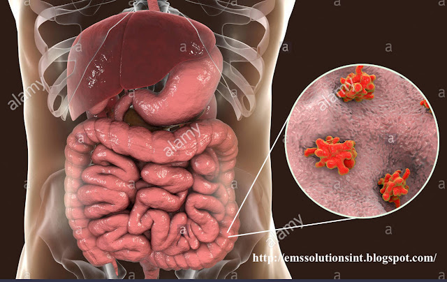 EMS SOLUTIONS INTERNATIONAL by @DrRamonReyesMD marca registrada ...