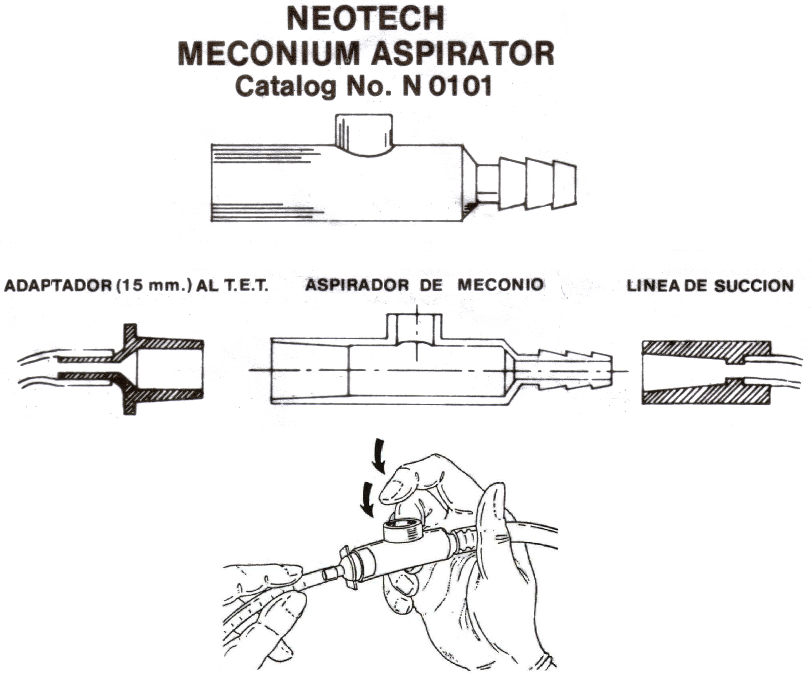 LA NEO DEL ENRIQUE GARCÉS EN QUITO - ECUADOR: La trampa de meconio