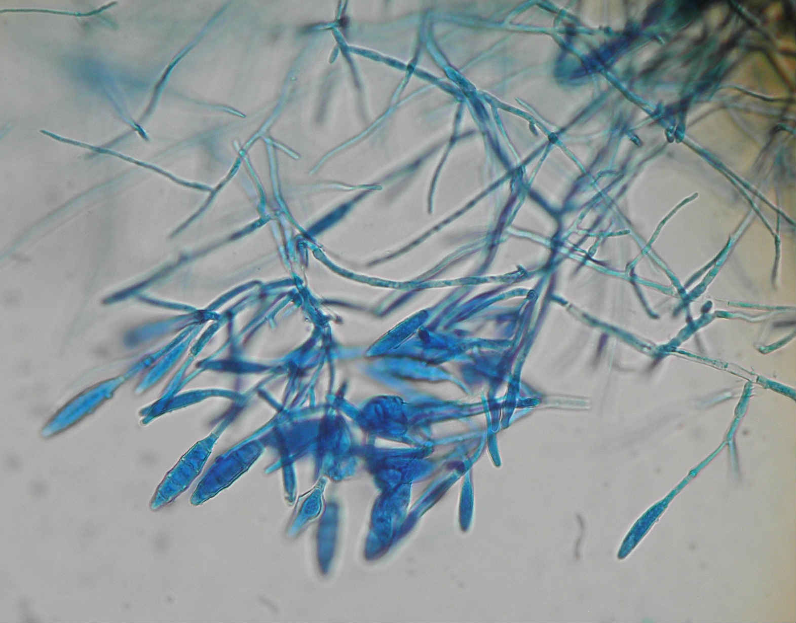 ATLAS MICOLOGIA: MICROSPORUM GYPSEUM