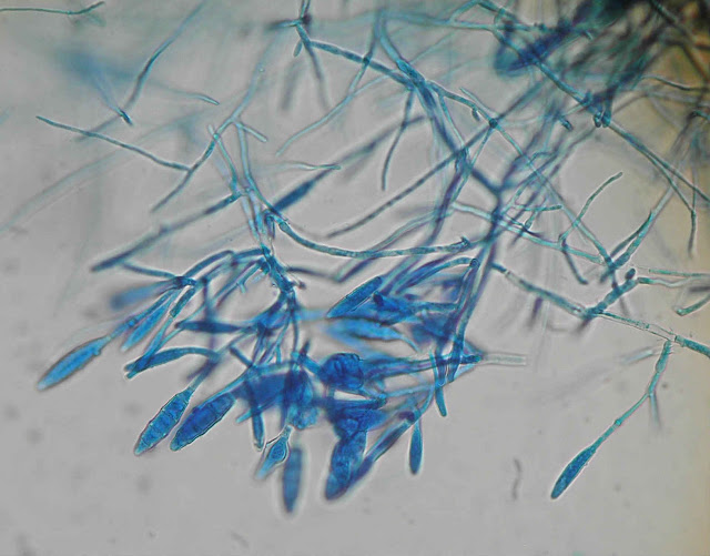 ATLAS MICOLOGIA: MICROSPORUM GYPSEUM