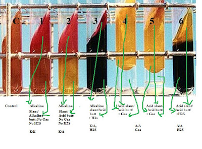 SENTHIL PRABHU SIVASAMY: Triple Sugar Iron (TSI) Test