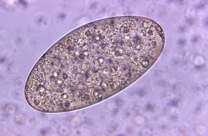 Parasitology 101: Fasciolopsis buski
