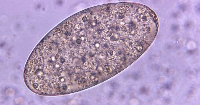 Parasitology 101: Fasciolopsis buski