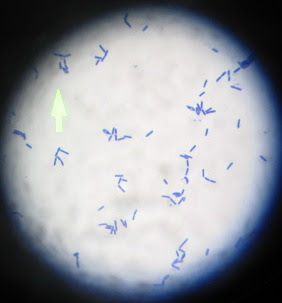PENGECATAN GRAM ~ Analis Kesehatan Indonesia