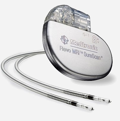 Marcapasos cardíaco: indicaciones, cirugía y evolución